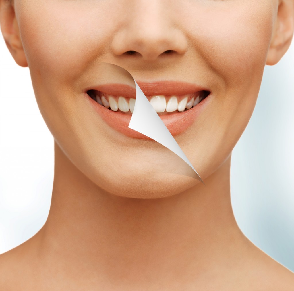 How To Get Gorgeous Results With A Smile Makeover | Beverly Rose, DMD
